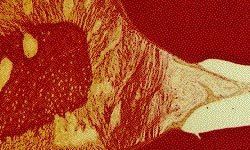 Peridontium